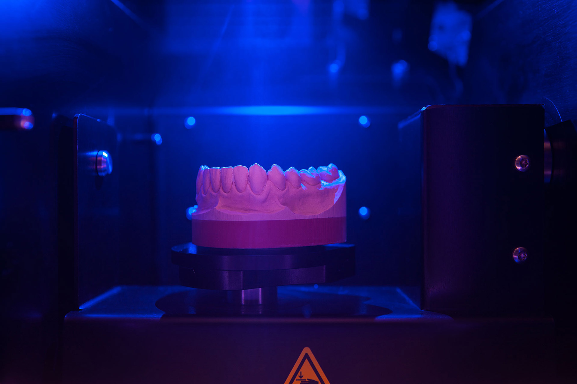 Smart Optics | XYZ Dental