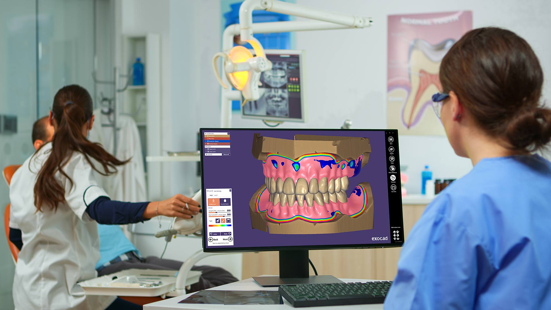 exocad DentalCAD | XYZ Dental