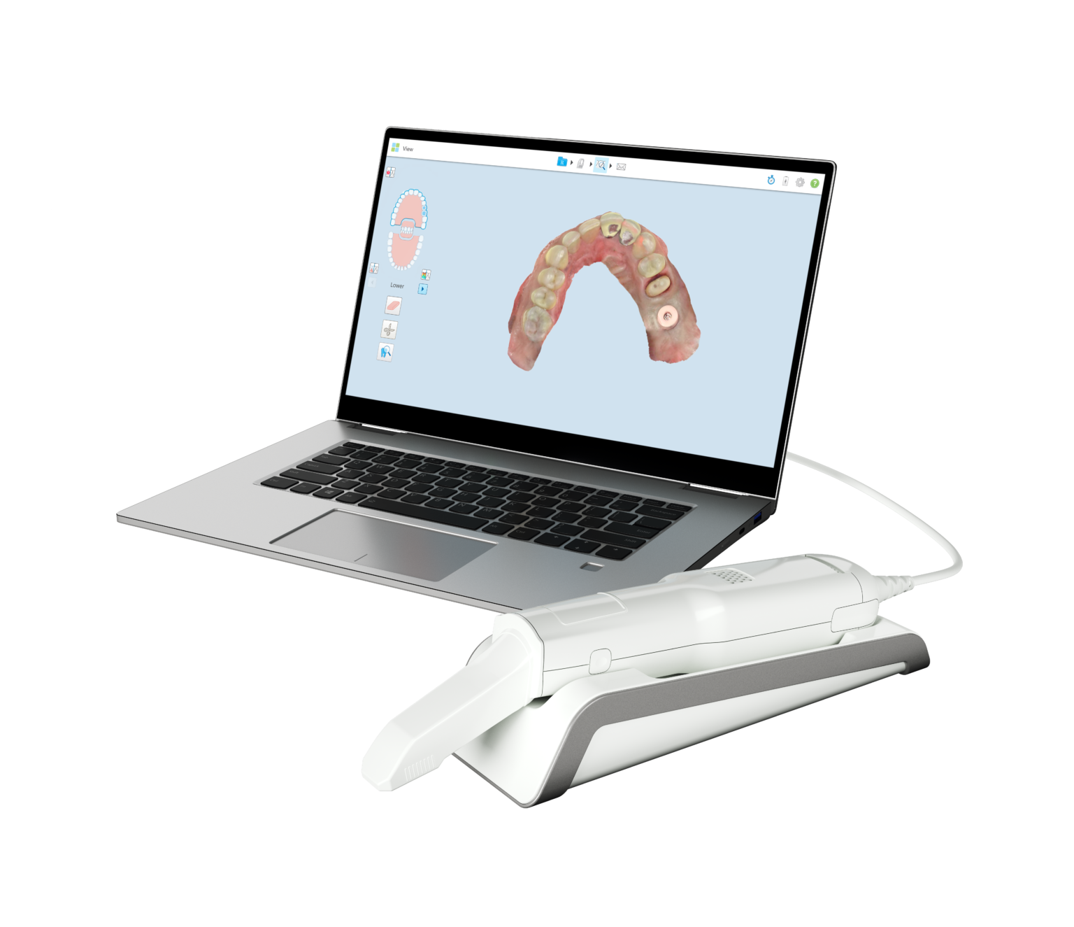 iTero Intraoral Scanners | XYZ Dental