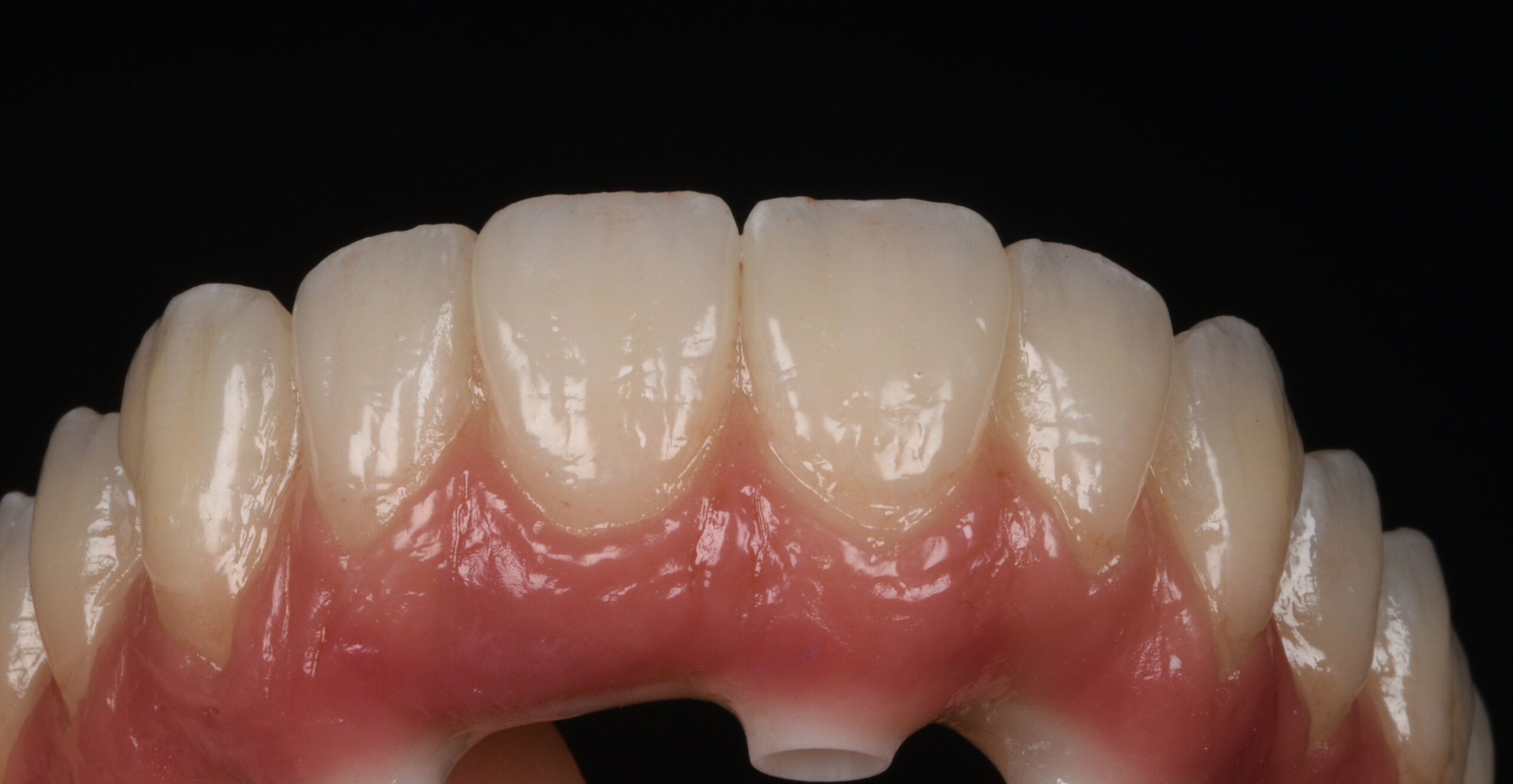 Multilayer & Multidimensional Zirconia | XYZ Dental